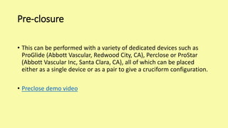 TAVI - Transcatheter Aortic Valve Implantation | PPTX | Heart and ...