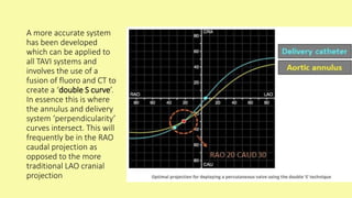 TAVI - Transcatheter Aortic Valve Implantation | PPTX