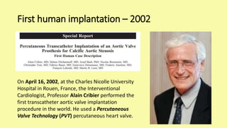 TAVI - Transcatheter Aortic Valve Implantation | PPTX