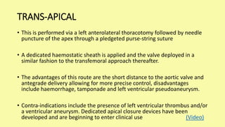 TAVI - Transcatheter Aortic Valve Implantation | PPTX