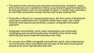 TAVI - Transcatheter Aortic Valve Implantation | PPTX