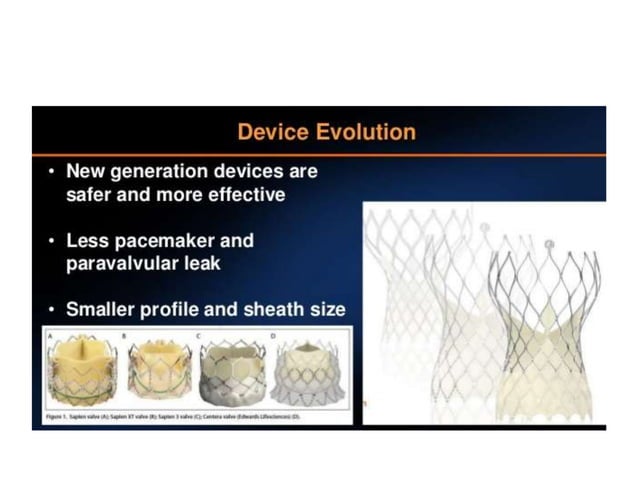 TAVR/TAVI/TRANCATHETER SAORTIC VALVE REPLECEMENT | PPTX | Heart and ...