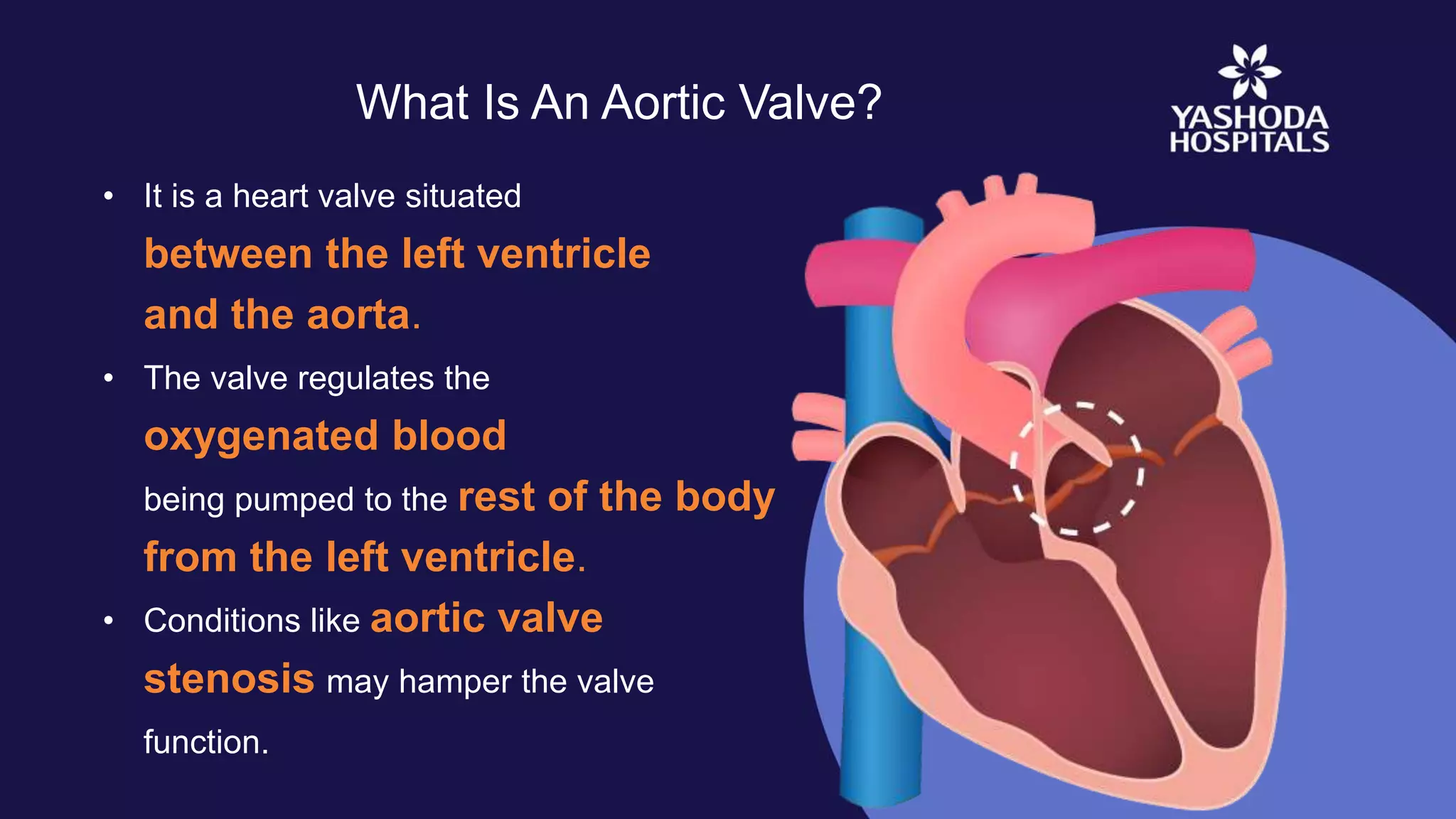 Transcatheter Aortic Valve Replacement (TAVR) | TAVR Procedure at ...