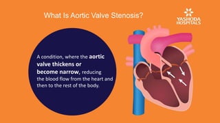 Transcatheter Aortic Valve Replacement (TAVR) | TAVR Procedure at Yashoda Hospitals | PPTX