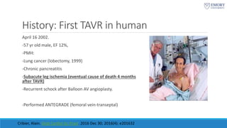 TAVR SAVR evolution of a groundbreaking therapy | PPTX
