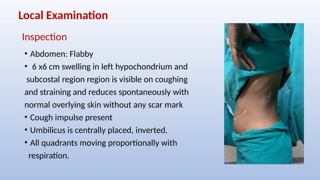 Traumatic Anterior Abdominal Wall Hernia | PPTX
