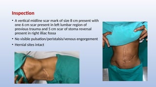 Traumatic Anterior Abdominal Wall Hernia | PPTX