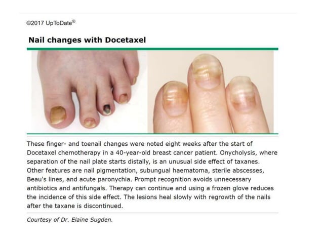 Taxane - management of side effects | PPT