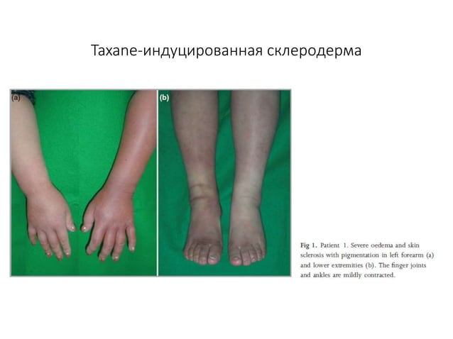 Taxane - management of side effects | PPT