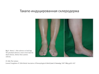 Taxane - management of side effects | PPT
