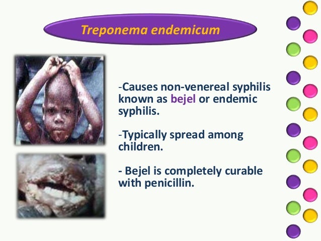 Taxonomy of bacteria