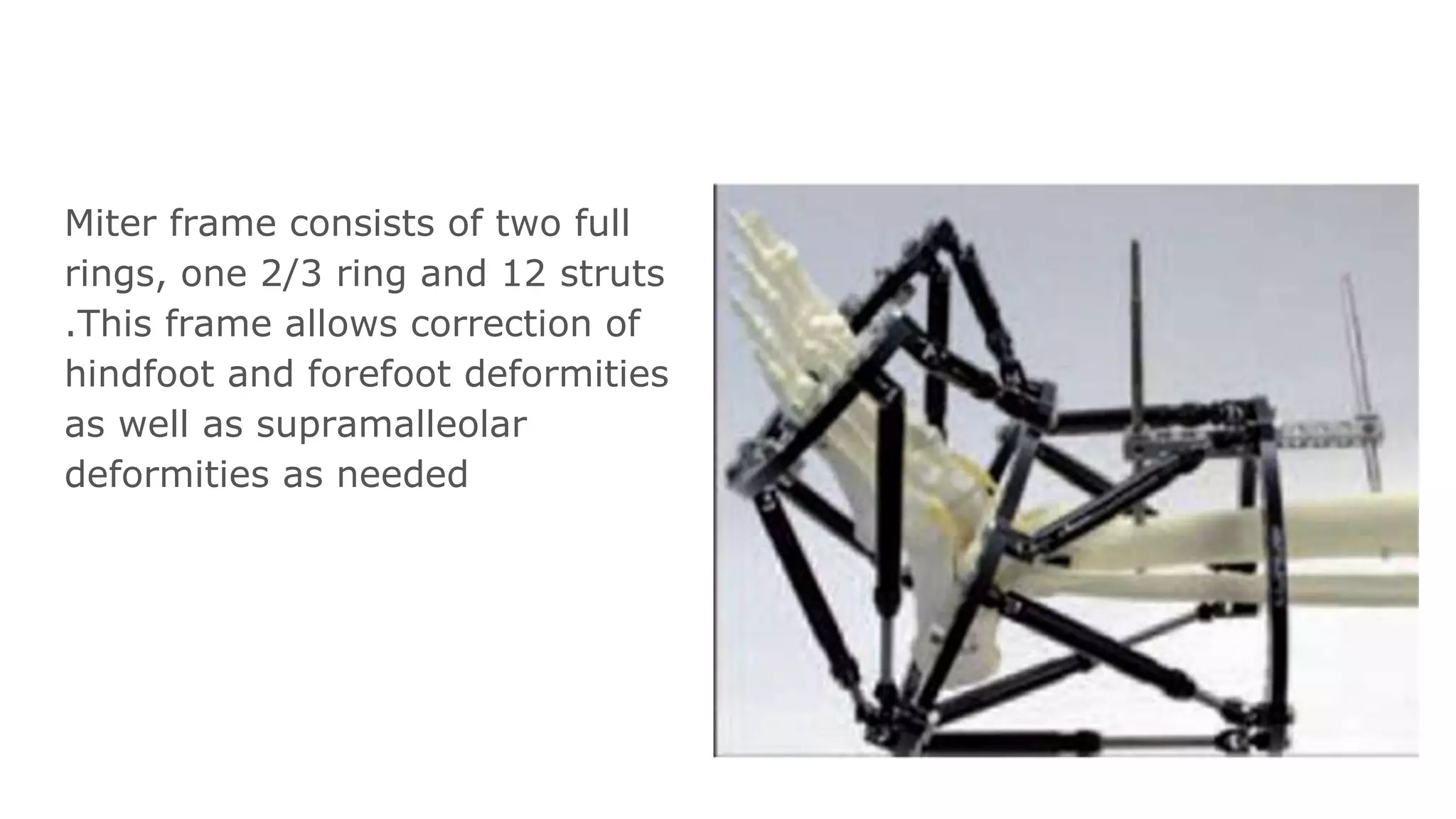 Taylor spatial frame | PPTX