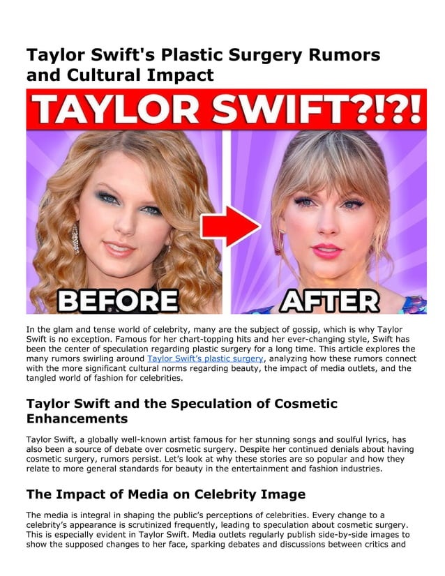 Taylor Swift's Plastic Surgery Rumors and Cultural Impact | PDF