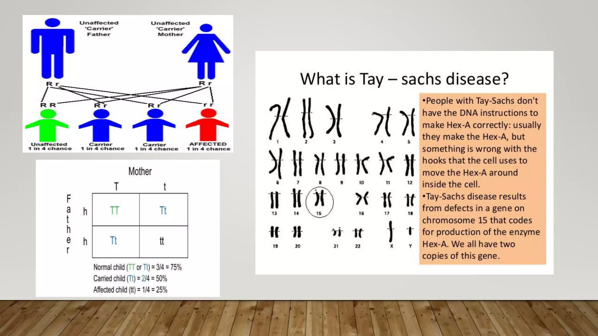 Tay sach disease ppt 1 | PPTX