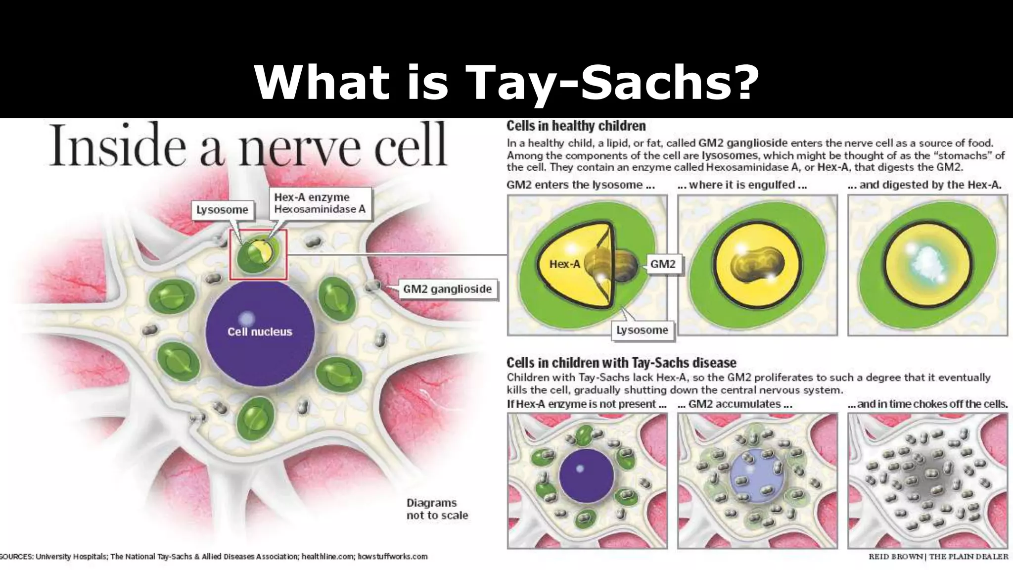 Tay Sachs disease | PPTX