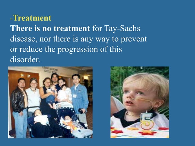 Tay sachs DISEASE | PPTX | Brain and Nervous System Disorders ...