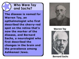 Tay – sachs disease | PPTX