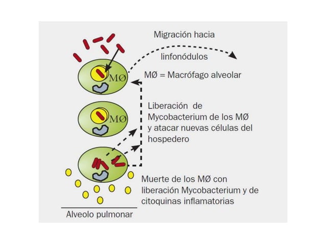 Tuberculosis | PPTX