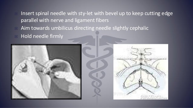 LUMBAR PUNCTURE -by Amiteshwar Reddy