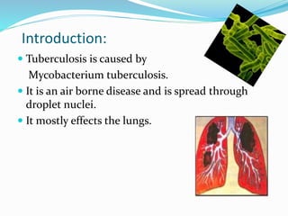 Tb | PPTX