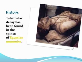 Tb | PPT | Free Download