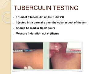 TUBERCULOSIS | PPTX