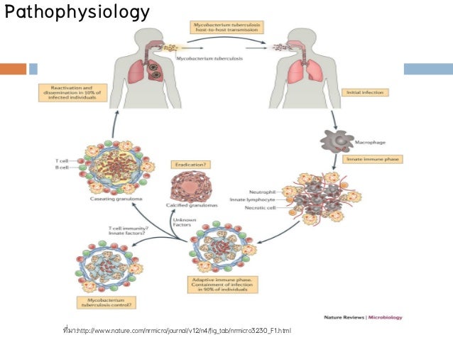 Pulmonary Tuberculosis Pathophysiology Diagram
