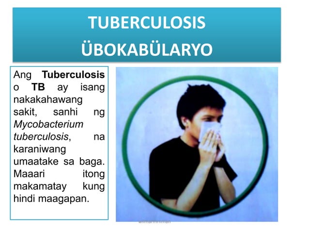 Tuberculosis | PPTX