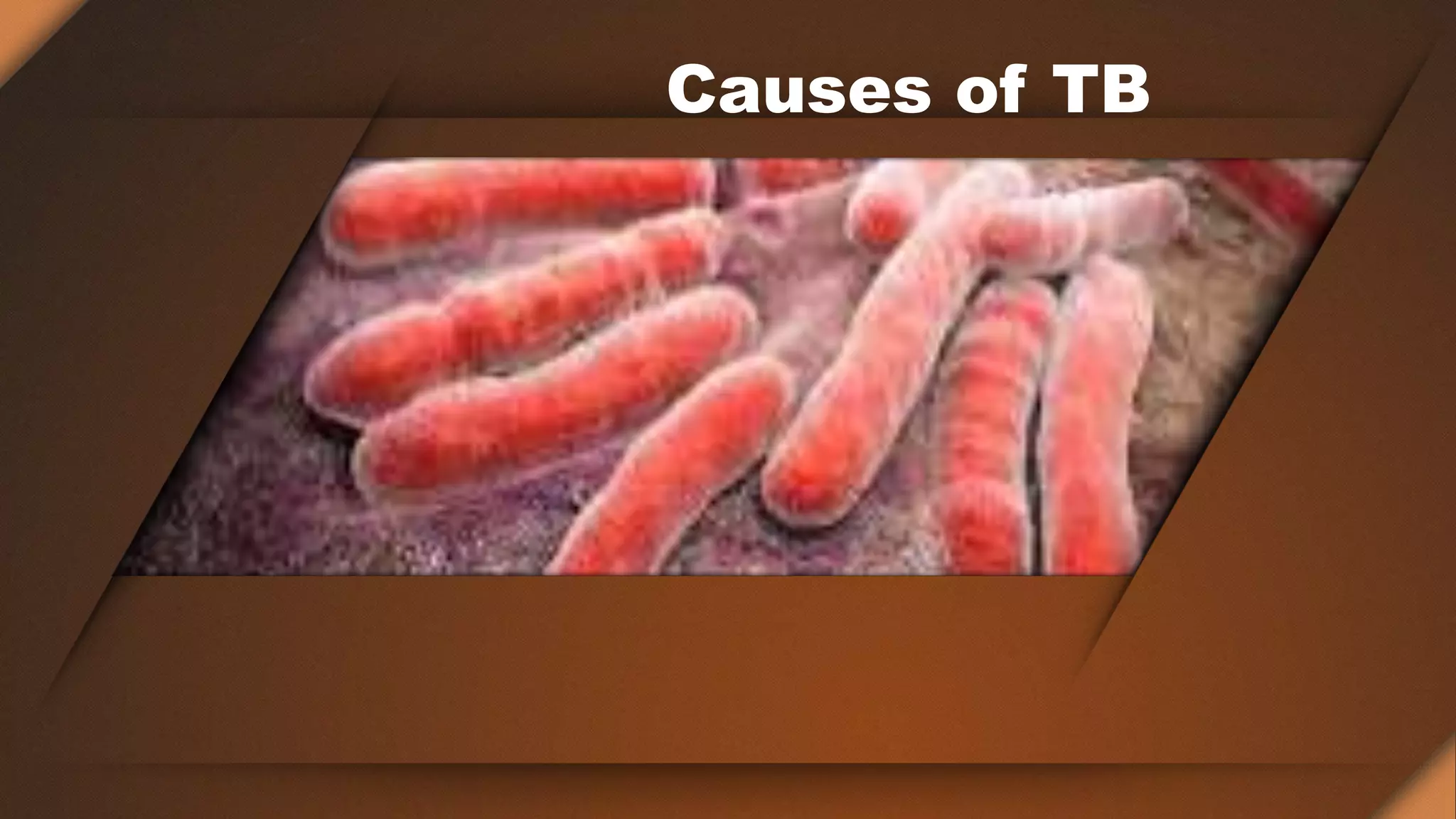Tuberculosis | PPTX