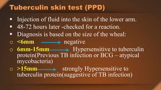 Tuberculosis | PPTX