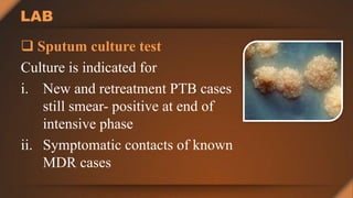 Sputum Culture Tb