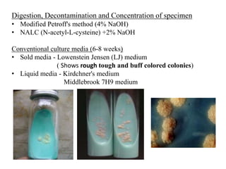 Mycobacterium | PPTX