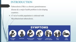 TB.pptx