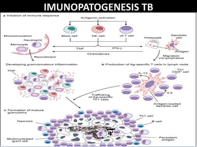 Tuberkulosis TB, RSUD JAYAPURA, FK Uncen.pptx