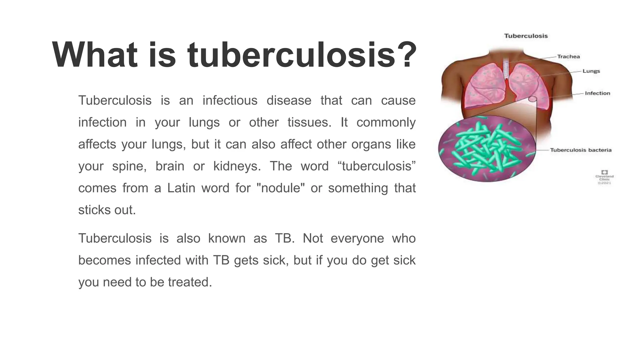 What is Tuberculosis TB management of Tb | PPTX