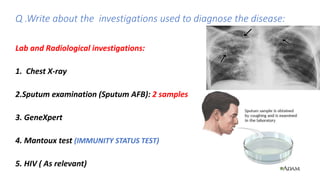Tuberculosis,TB,COMMUNITY MEDICINE,MBBS,MD,BPH,MPH,DR NARENDRA KUMAR ...