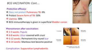 Tuberculosis,TB,COMMUNITY MEDICINE,MBBS,MD,BPH,MPH,DR NARENDRA KUMAR ...