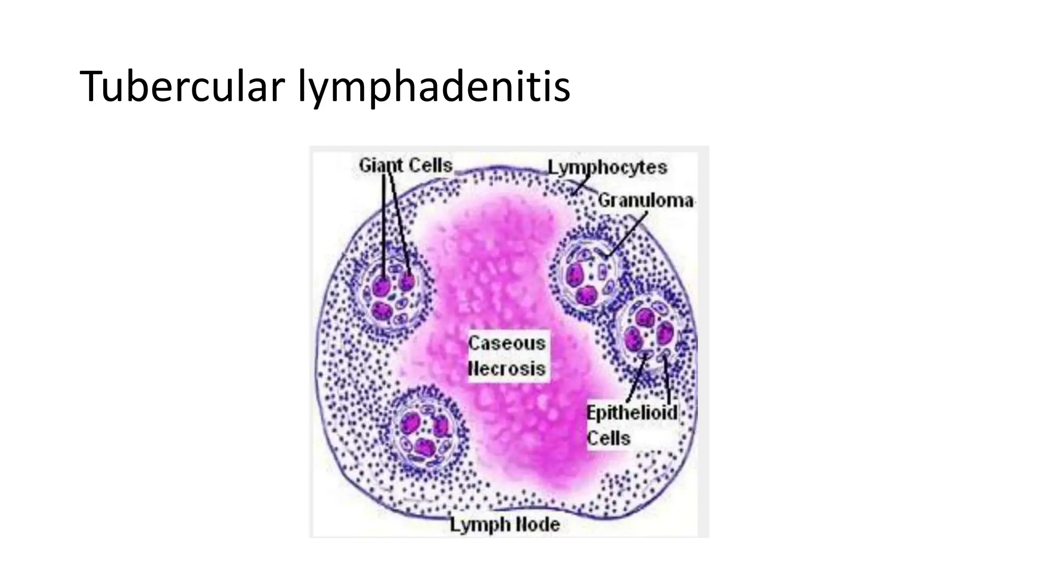 Tuberculosis histology pictures explained.pptx