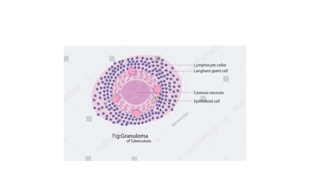 Tuberculosis histology pictures explained.pptx