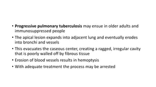 Tuberculosis histology pictures explained.pptx