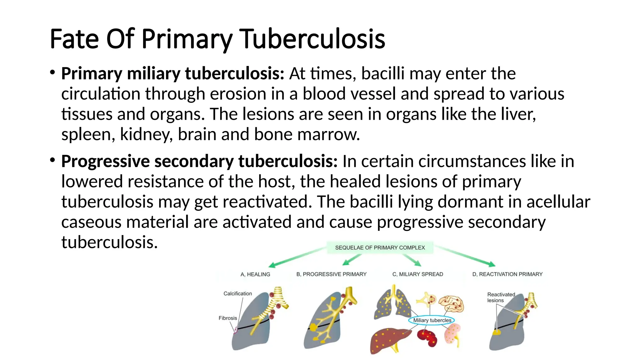 Pathology of Tuberculosis, pathogenesis of Tuberculosis | PPTX