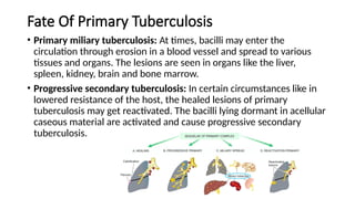 Pathology of Tuberculosis, pathogenesis of Tuberculosis | PPTX