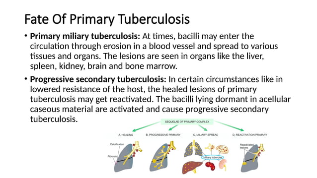 Pathology of Tuberculosis, pathogenesis of Tuberculosis | PPTX | Lung ...