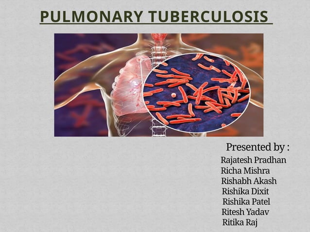 Tuberculosis MBBS For medical College and Hospital ppt | PPTX