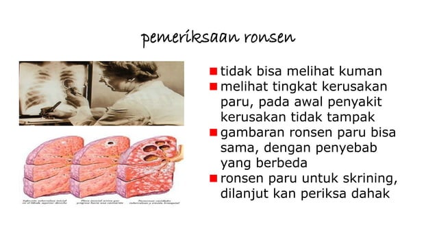 TB paru merupakan penyakit yang kronis pada setiap orang | PPT