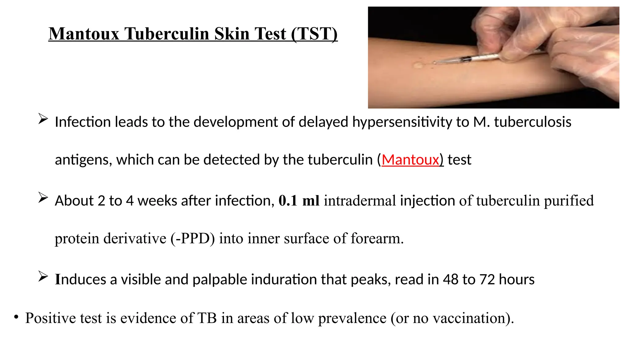 Mycobacterium tuberculosis diagnosis and treatment.pptx