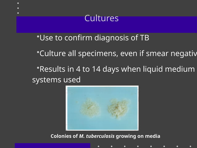 Tuberculosis: diagnosis, treatment ,prevention.pptx