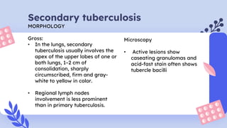 Tuberculosis, primary and secondary tuberculosis | PPT