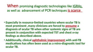 Presumed ocular tuberculosis, identification .pptx
