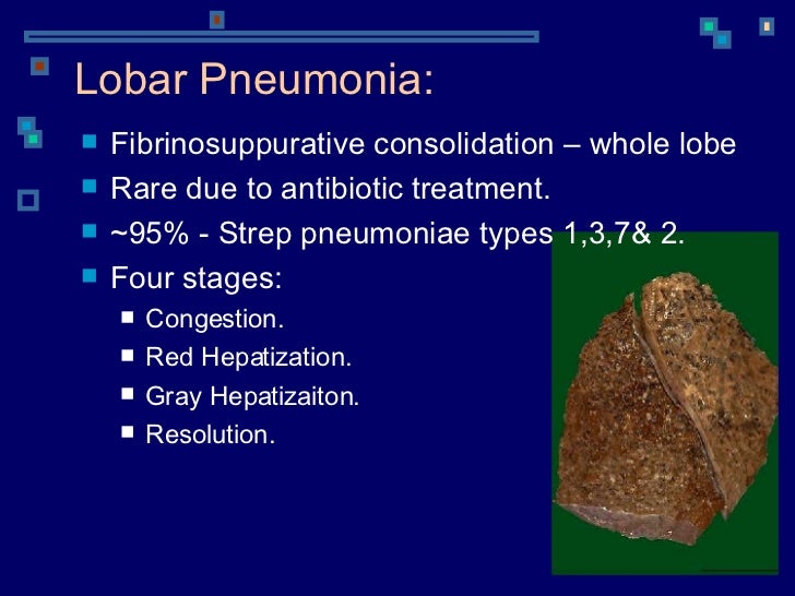Nephronia Treatment